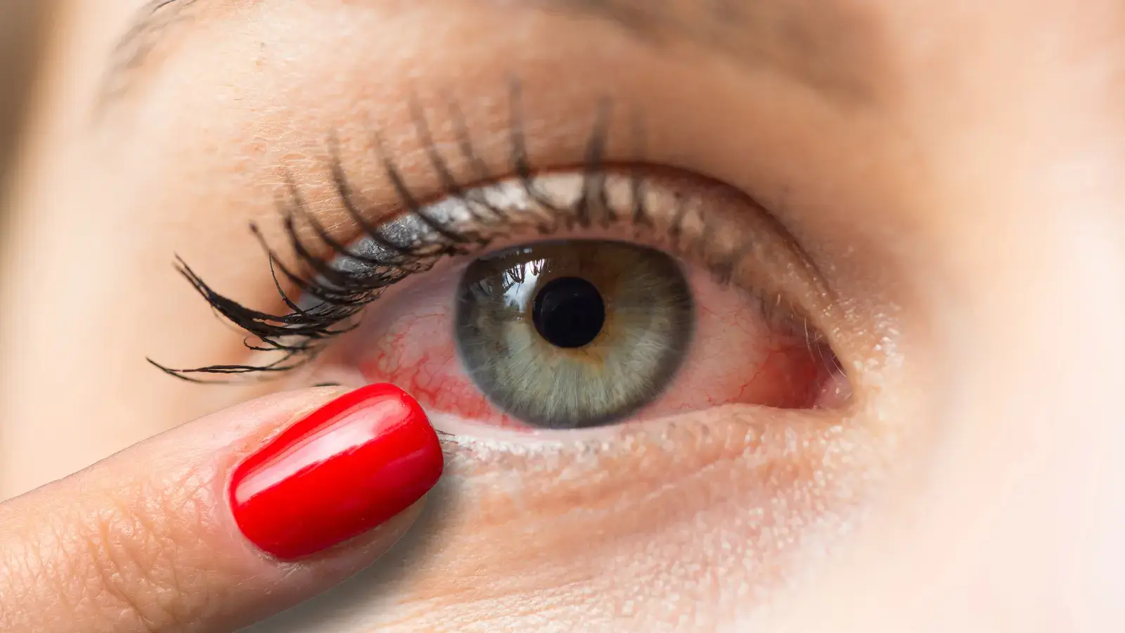 Discover Signs, Solutions, & Treatments of Dry Eye Symptoms